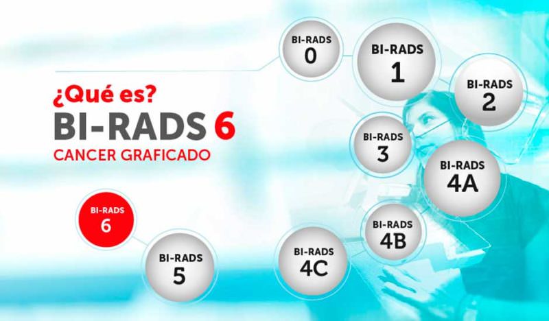 ¿El Birads 4 en una mamografía es cáncer? - Diagnóstico Rojas